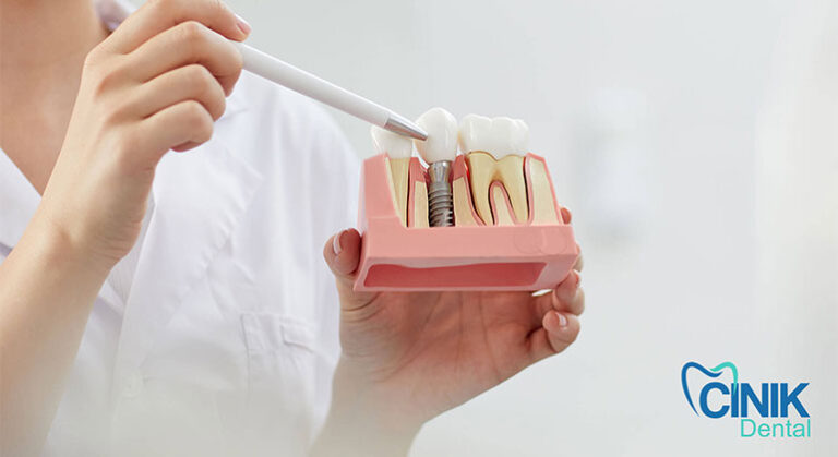 Things to Know About Dental Aesthetics - Cinik Dental