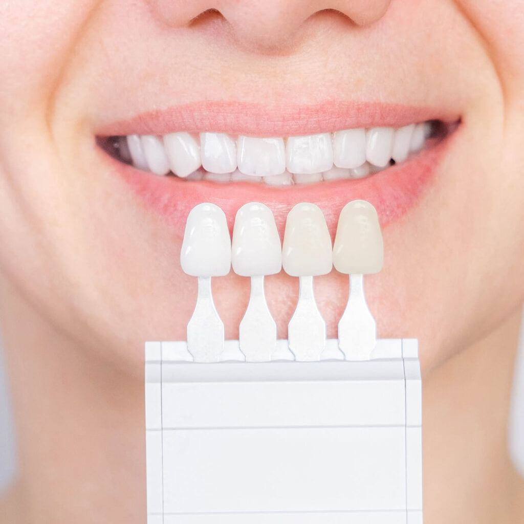 Best Porcelain Laminate Veneers & Dr. Cinik Dental Clinic Istanbul